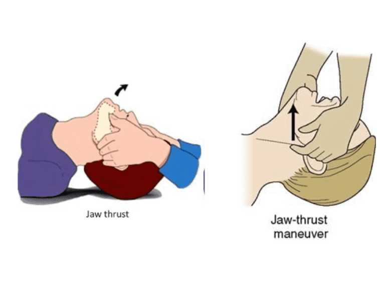 NREMT Study Guide | Airway, Breathing & Ventilation